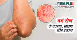 चर्म रोग (त्वचा विकार) के कारण, लक्षण, इलाज, दवा और परहेज - Charm Rog ...