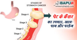 पेट के कैंसर का उपचार, खान-पान और परहेज - Pet Ke Cancer Ka Upchar In ...